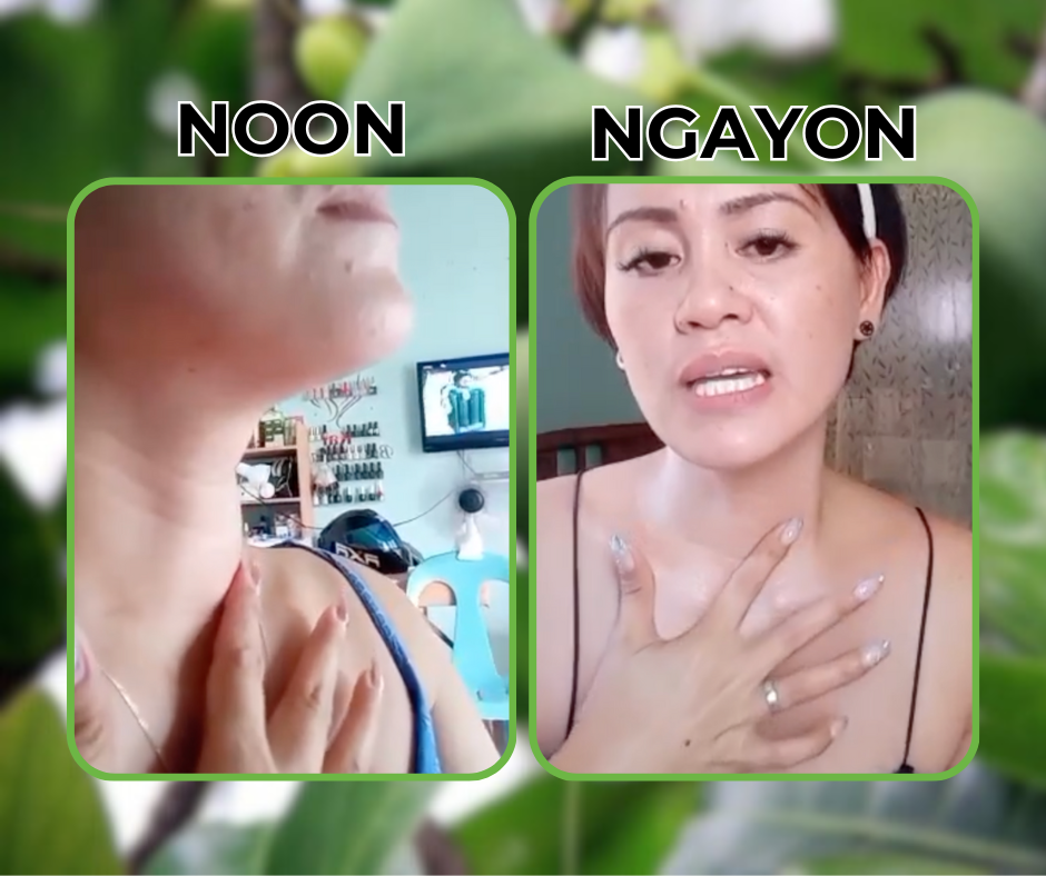 Mark and Maria's Bitoon Herbal Oil (Buy 1 Get 1) – Mark and Marias ...