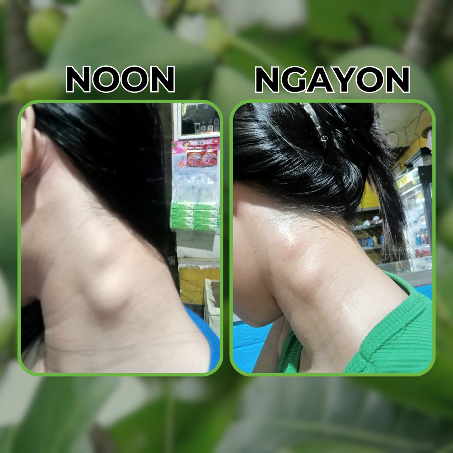 Mark and Maria's Bitoon Herbal Oil (Buy 1 Get 1) – Mark and Marias Essentials