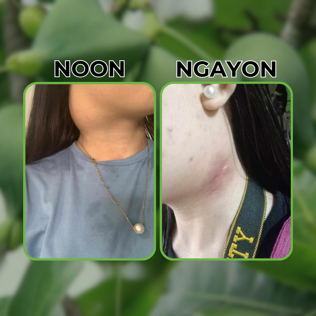 Mark and Maria's Bitoon Herbal Oil (Buy 1 Get 1) – Mark and Marias ...